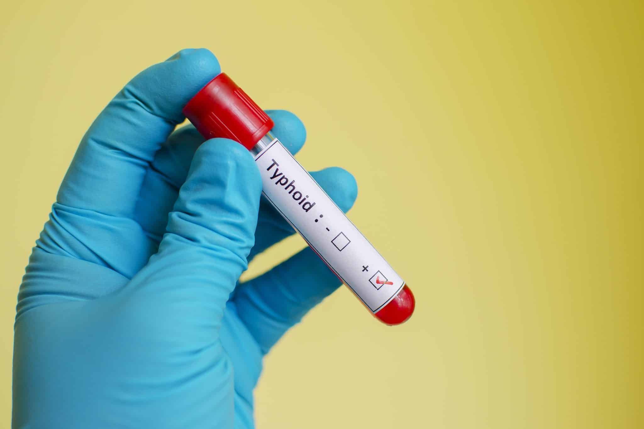 Can typhoid fever spread through the air?