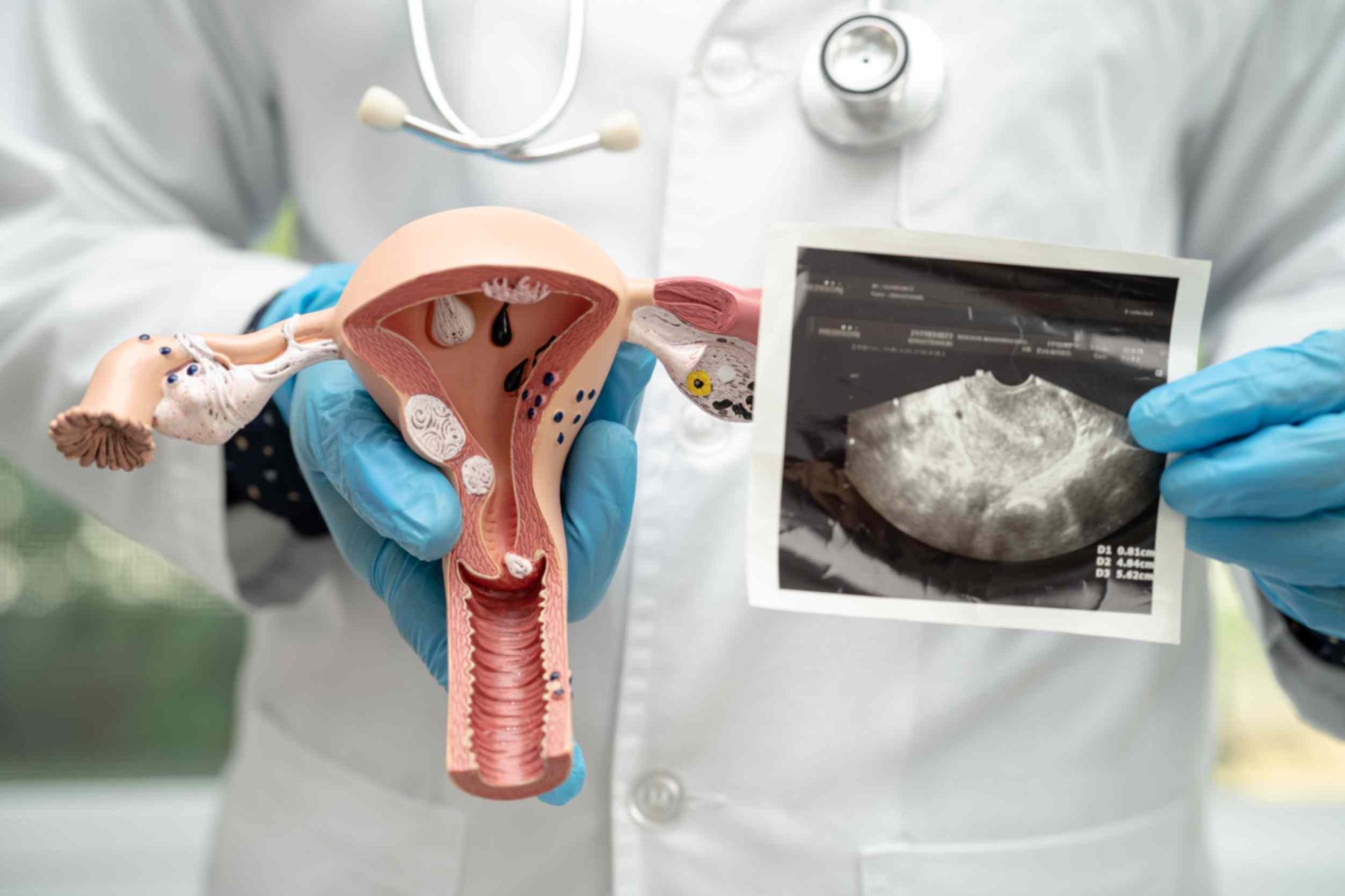 What Are the Early Signs and Symptoms of HPV? - Touchwood Pharmacy